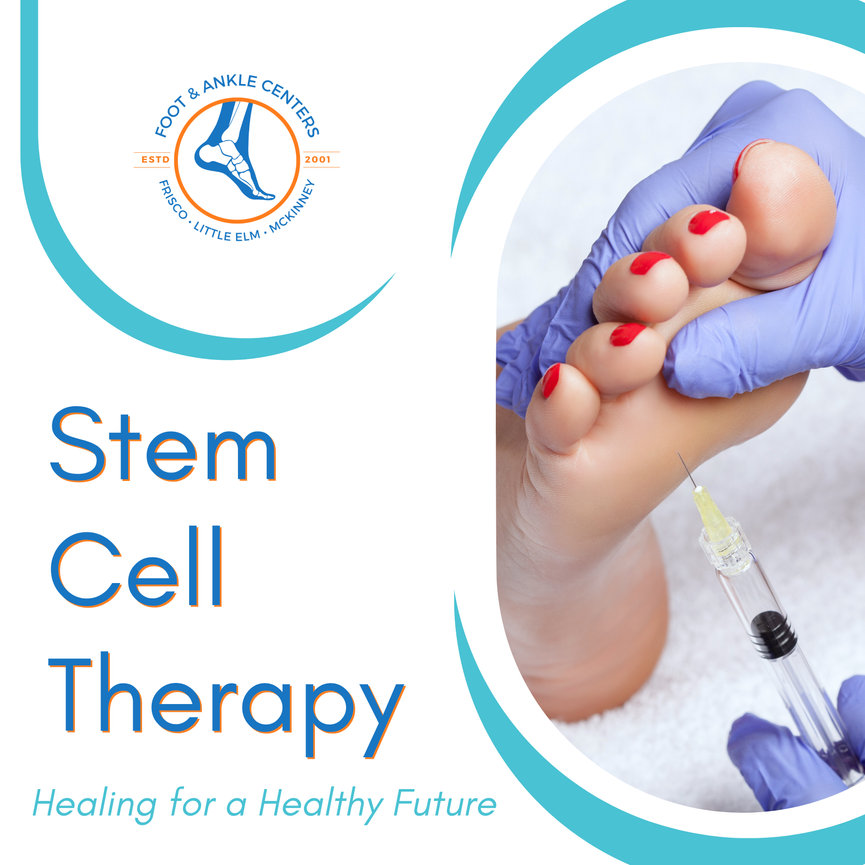 Regenerative Stem Cell Therapy - Foot & Ankle Centers of Frisco and Plano