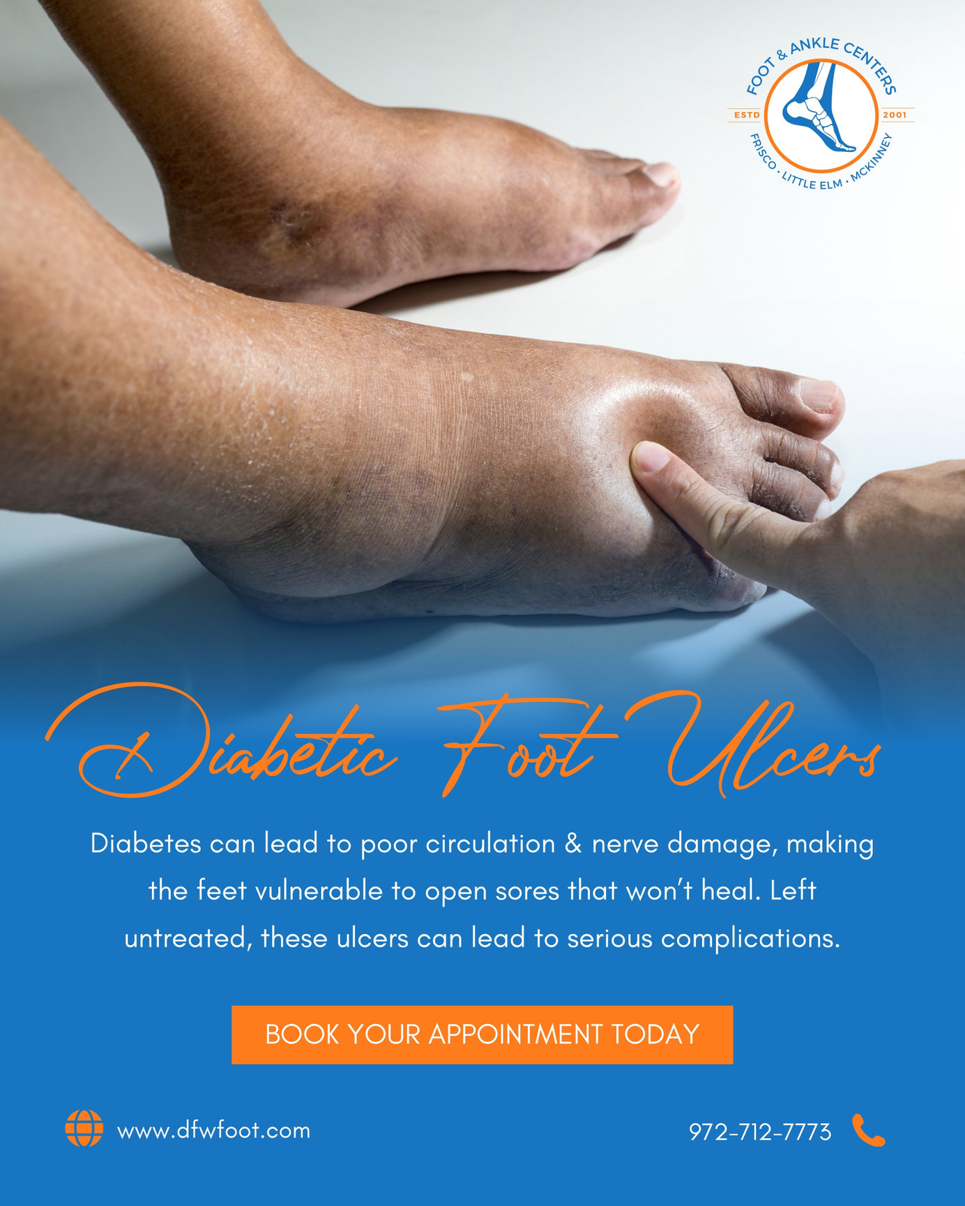 Diabetic Foot Ulcers Treatment at Foot & Ankle Centers